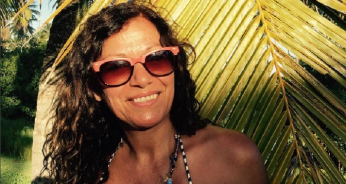 La verdad tras compleja cirugía plástica de Solange Lackington: vivió ...