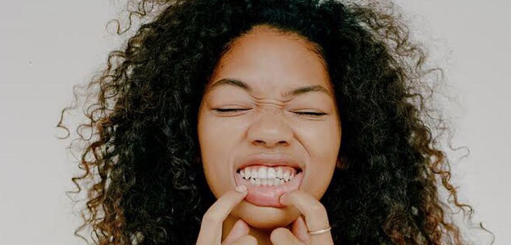 'Body Positive': tienda de ropa escogió a modelo sin un diente como rostro de su última campaña