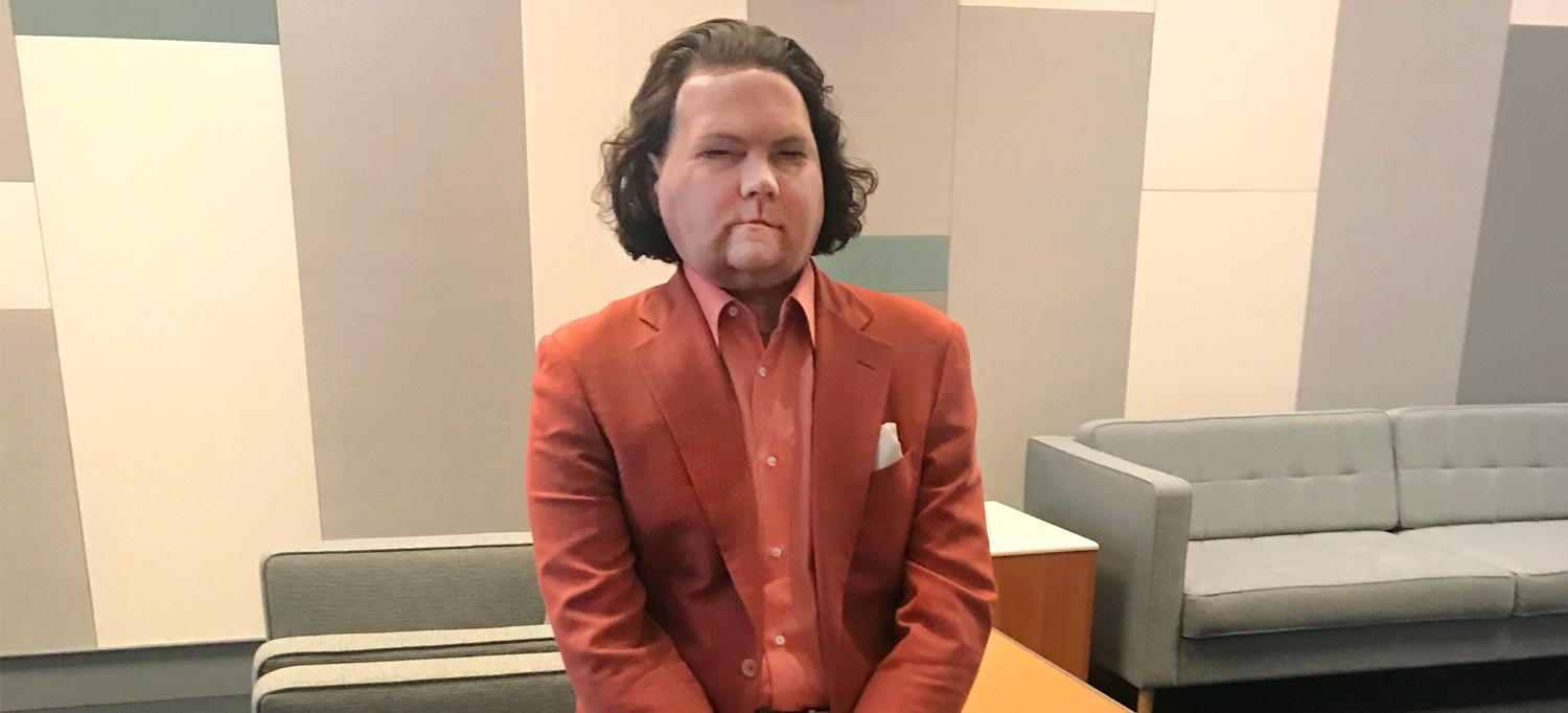 Joven al que le trasplantaron rostro y manos tras grave accidente: "Me ...