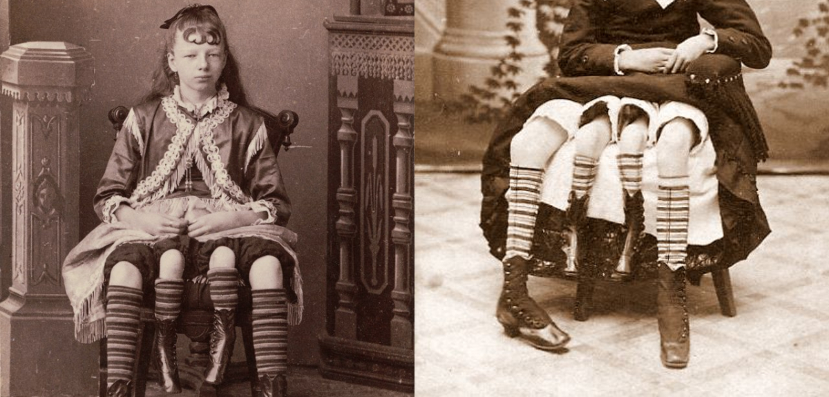 La increíble historia de Josephine Myrtle Corbin, la mujer ...