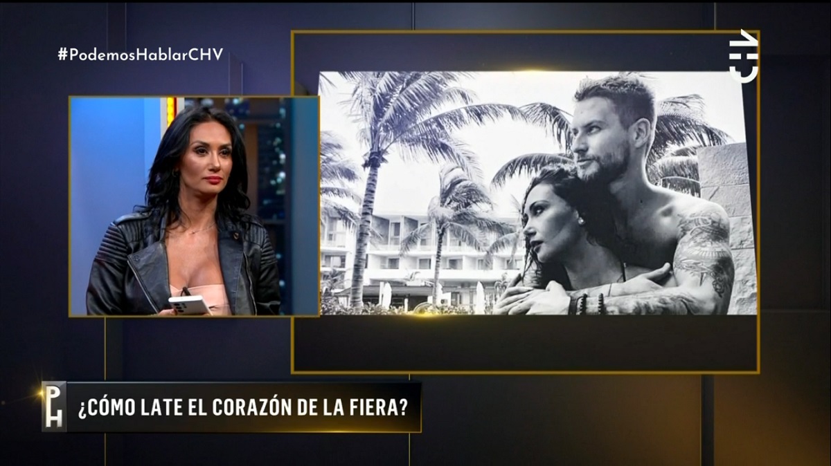 "La mejor parte del programa": Julio César bromeó con accidente estético de Pamela Díaz en 'PH'