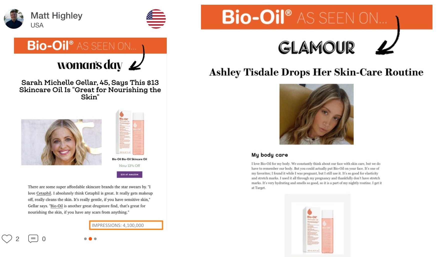 Los grandes olvidados de la belleza: conoce cómo evitar las rodillas y ...