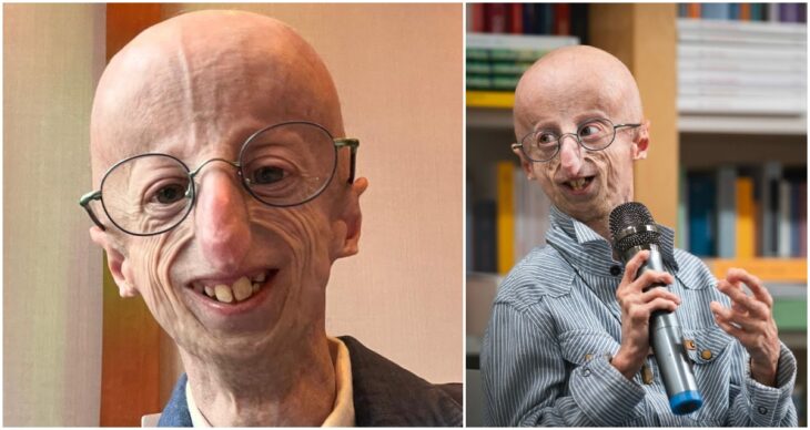 Muere Sammy Basso a los 28 años: visibilizó la progeria, enfermedad que ...