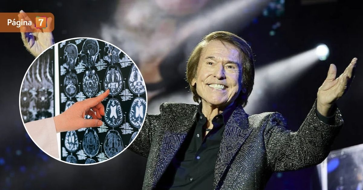 Tras Diagnóstico De Raphael ¿qué Es El Linfoma Cerebral Primario